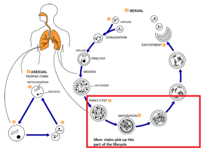Microbiological Diagnosis of PJP – PCR and Beta D glucan – Dr. Germophile