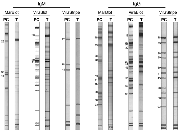 Lyme Disease Testing and the Multiverse of Madness – Dr. Germophile